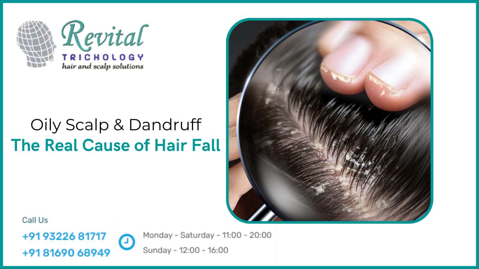 Oily Scalp, Dandruff & Hair Fall: Real Causes Explained